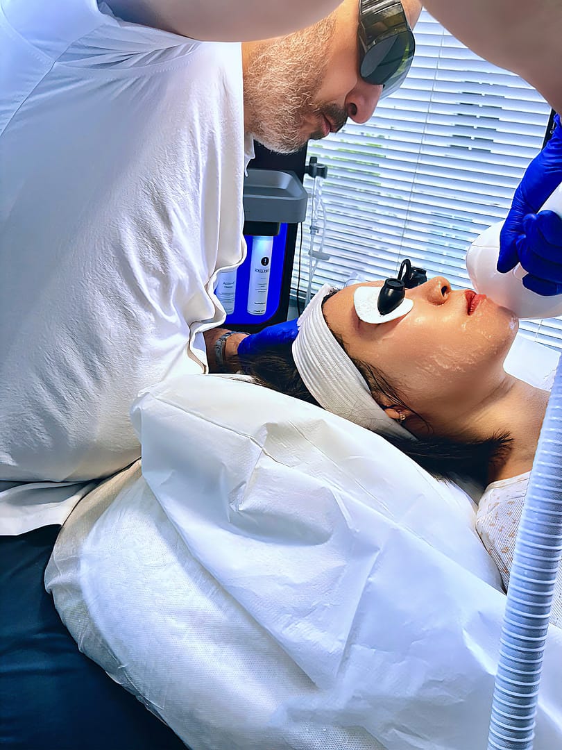 Lumecca IPL Photofacial Beverly Hills Treatment for Sun Damaged Skin